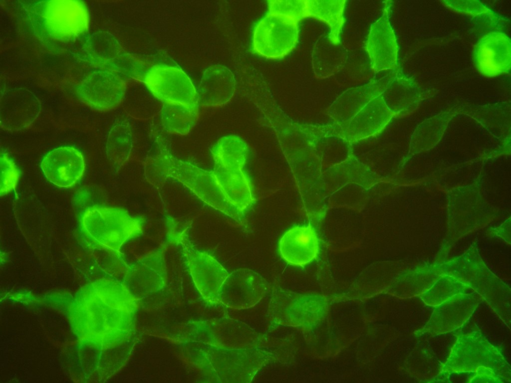 Custom soluble proteins – CytobodX